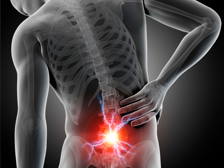 Sabia que uma simples dor nas costas pode ser problema renal? – O que ...